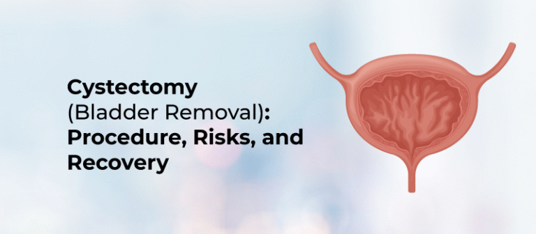 Best Nephrology And Urology Hospital In India | AINU Hospitals